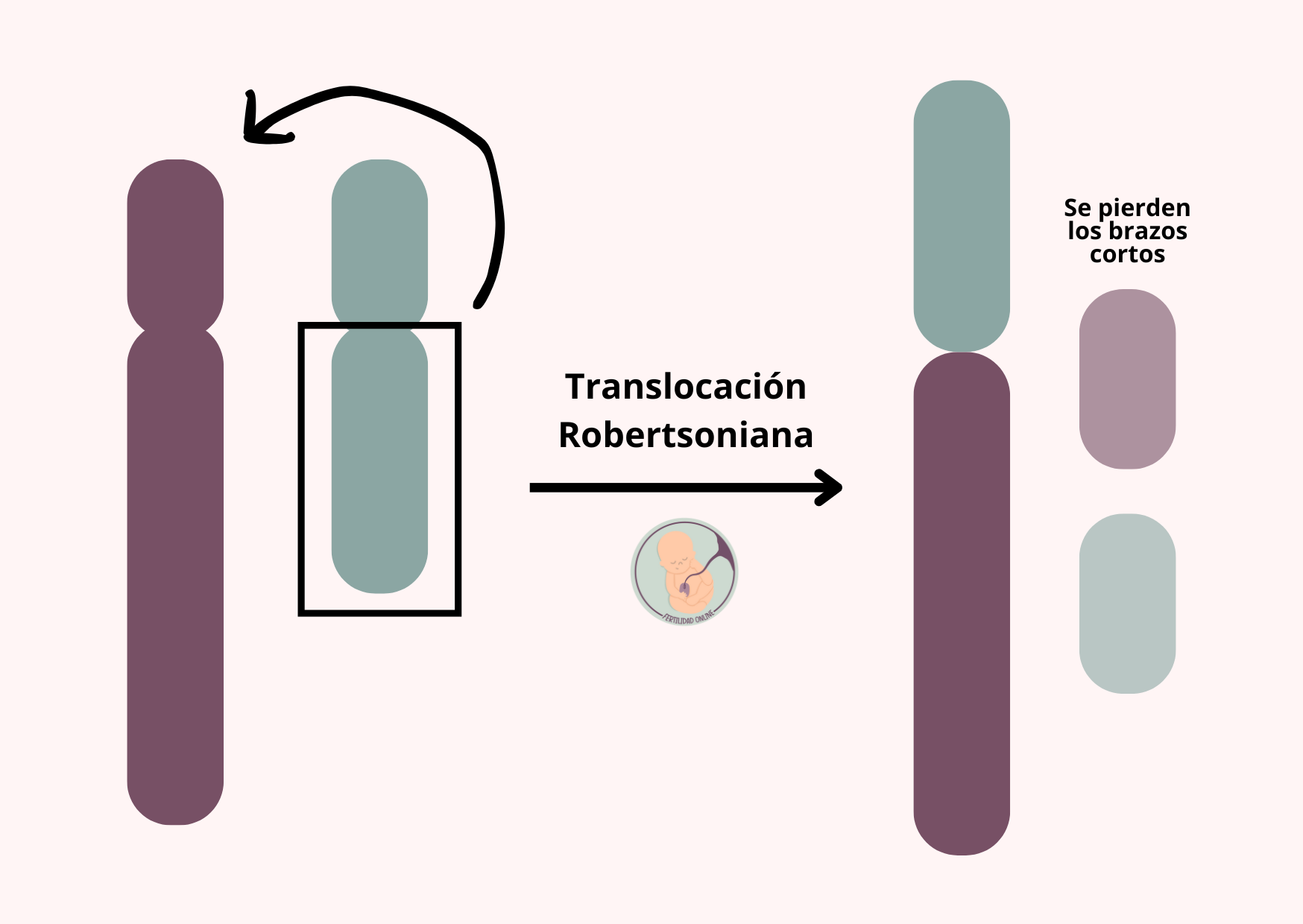 Genética e Infertilidad: Translocaciones Cromosómicas - Fertilidad Online